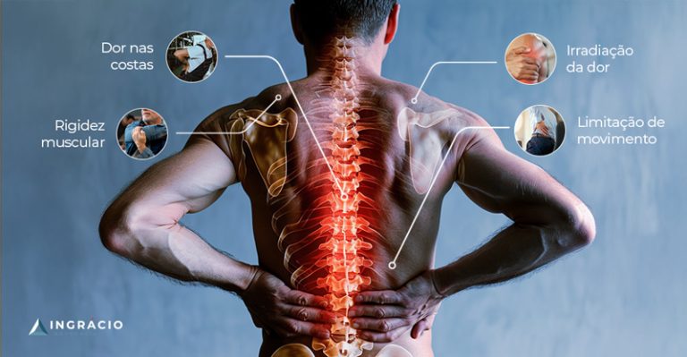CID M54 (dorsalgia): quais os direitos de quem tem a condição?
